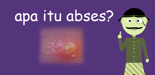 Apa Itu Abses atau Bisul: Gejala, Penyebab, Diagnosis, dan Obat Herbalnya ~ Yo Herbal