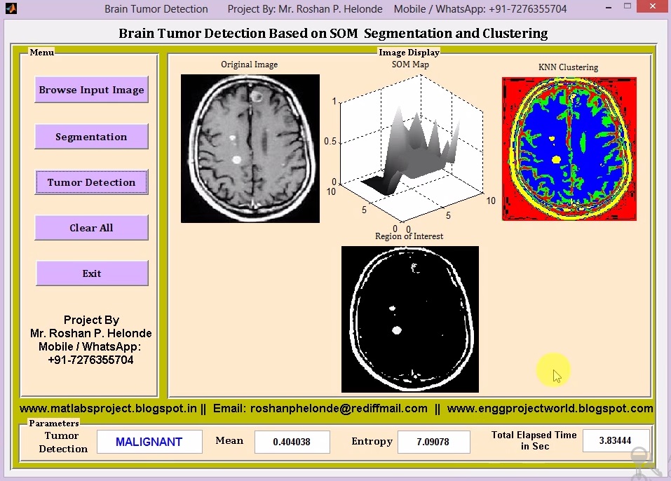 Matlab Code For Brain Tumor Detection On Mri Images Using Segmentation And Clustering Project