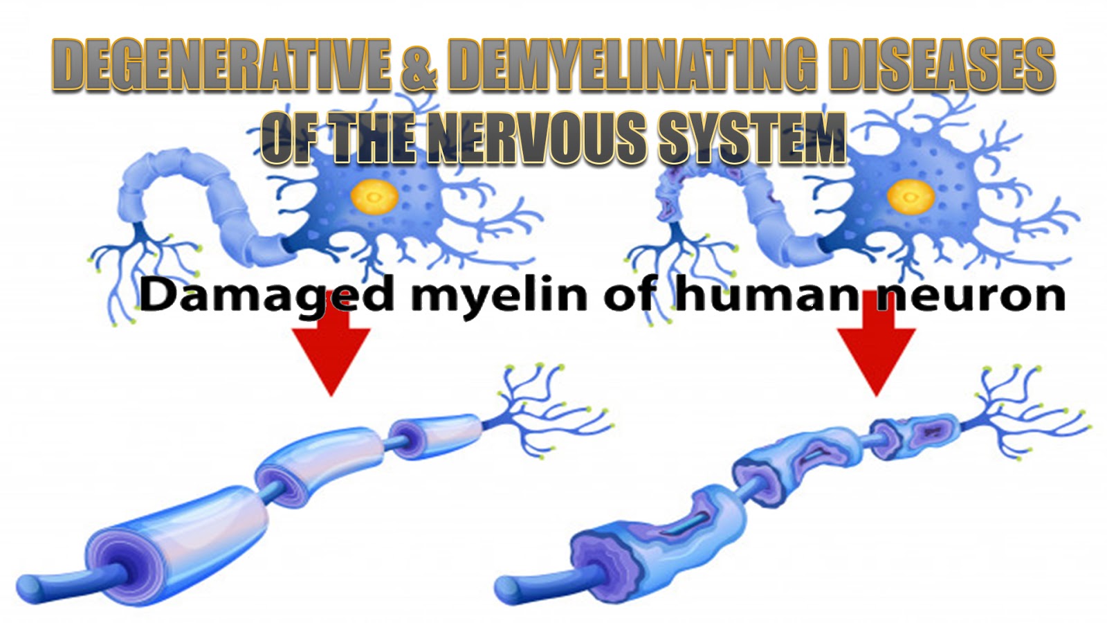 Degenerative And Demyelinating Diseases Of The Nervous System