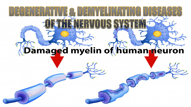 Degenerative And Demyelinating Diseases Of The Nervous System