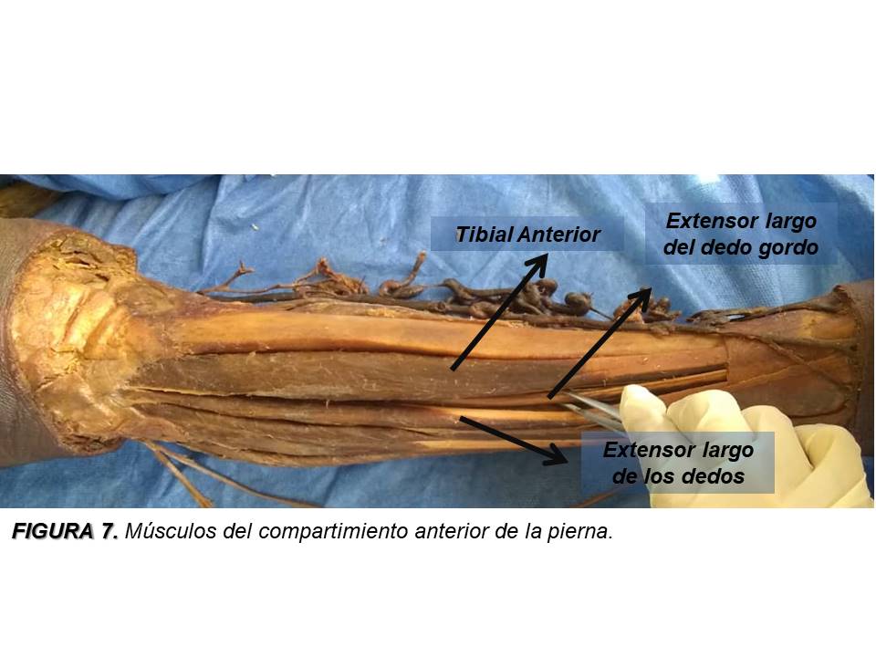 Disección de Pierna Completa - Medicina Valera