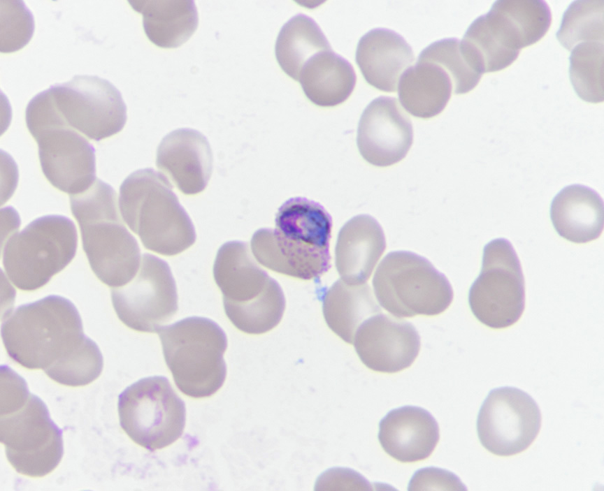 Creepy Dreadful Wonderful Parasites: Case of the Week 564