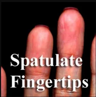 Palmistry Fingertips | Spatulate Fingertips Personality ~ INDIAN ...
