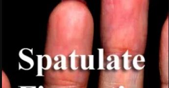 Palmistry Fingertips | Spatulate Fingertips Personality ~ INDIAN ...