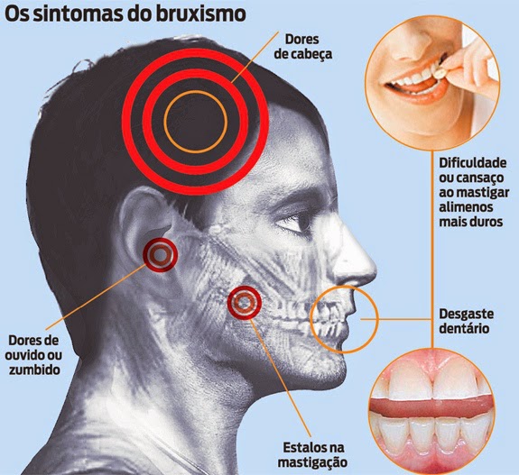 Cantinho Terapêutico Namastê: Dor Orofacial - DTM e ATM- Bruxismo