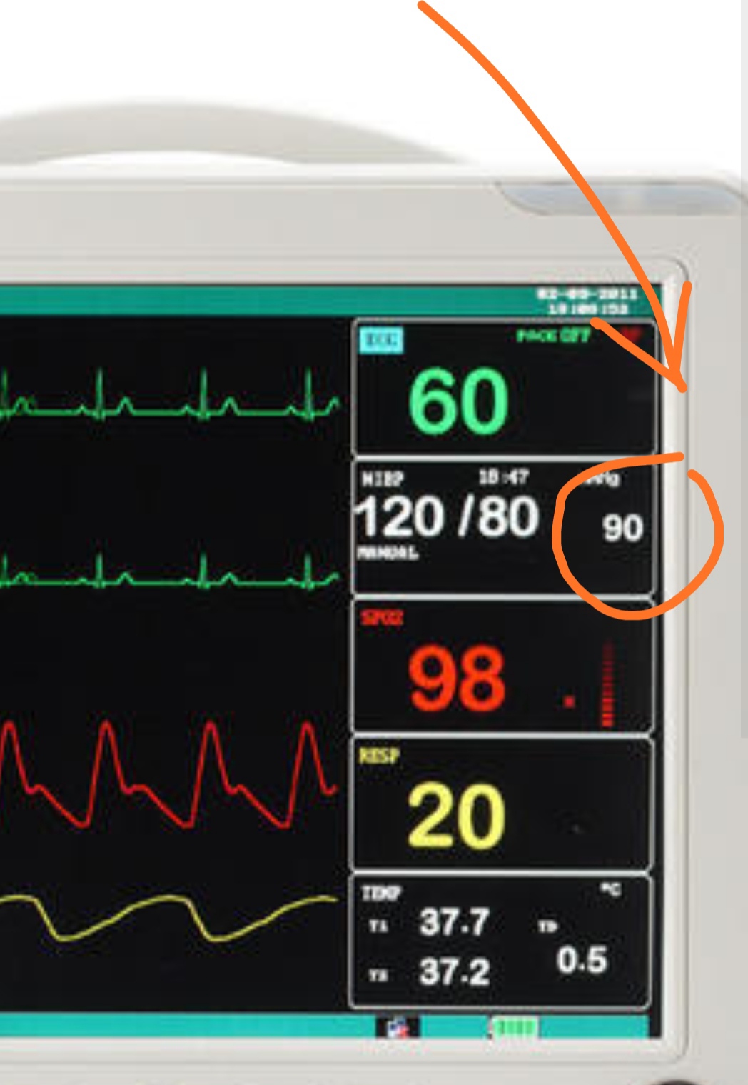 Mean Arterial Pressure Anesthesiology And Intensive Care mean-arterial-pressure-anesthesiology-and-intensive-care