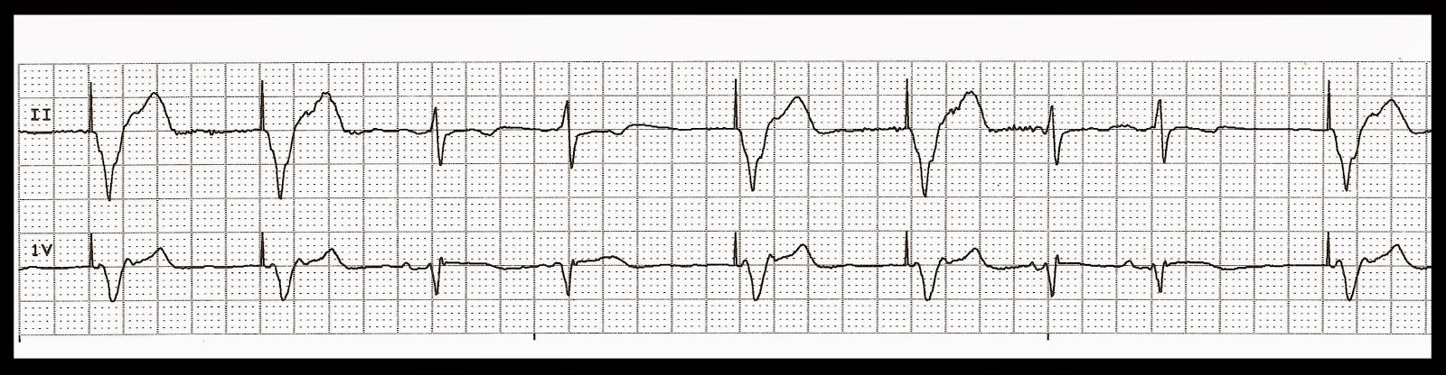 Practice EKG Strips 397