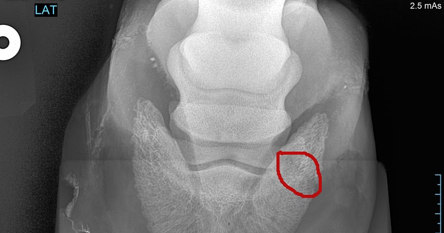 Hewi: Kavioluun murtuma