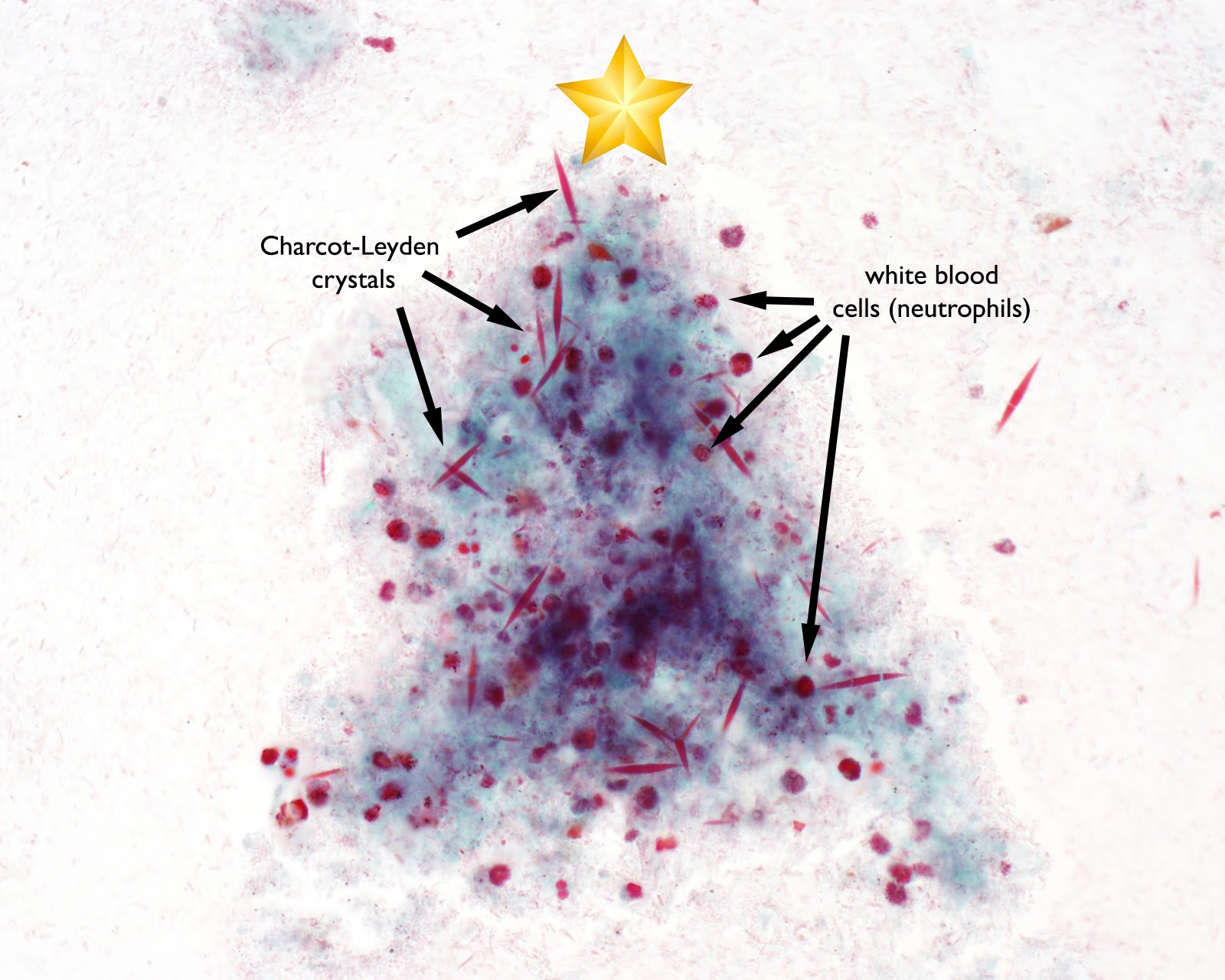 Creepy Dreadful Wonderful Parasites: December 2017