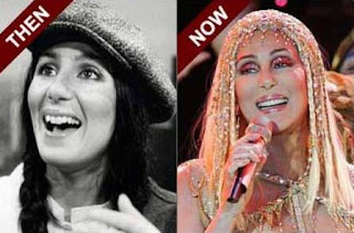 Cher Plastic Surgery