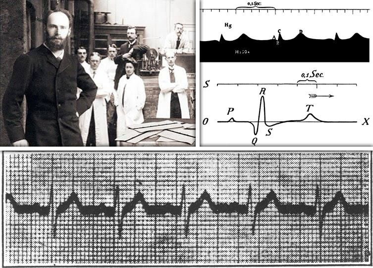 AN ERA IN TIME: THE ELECTROCARDIOGRAM By Willem Einthoven 1903