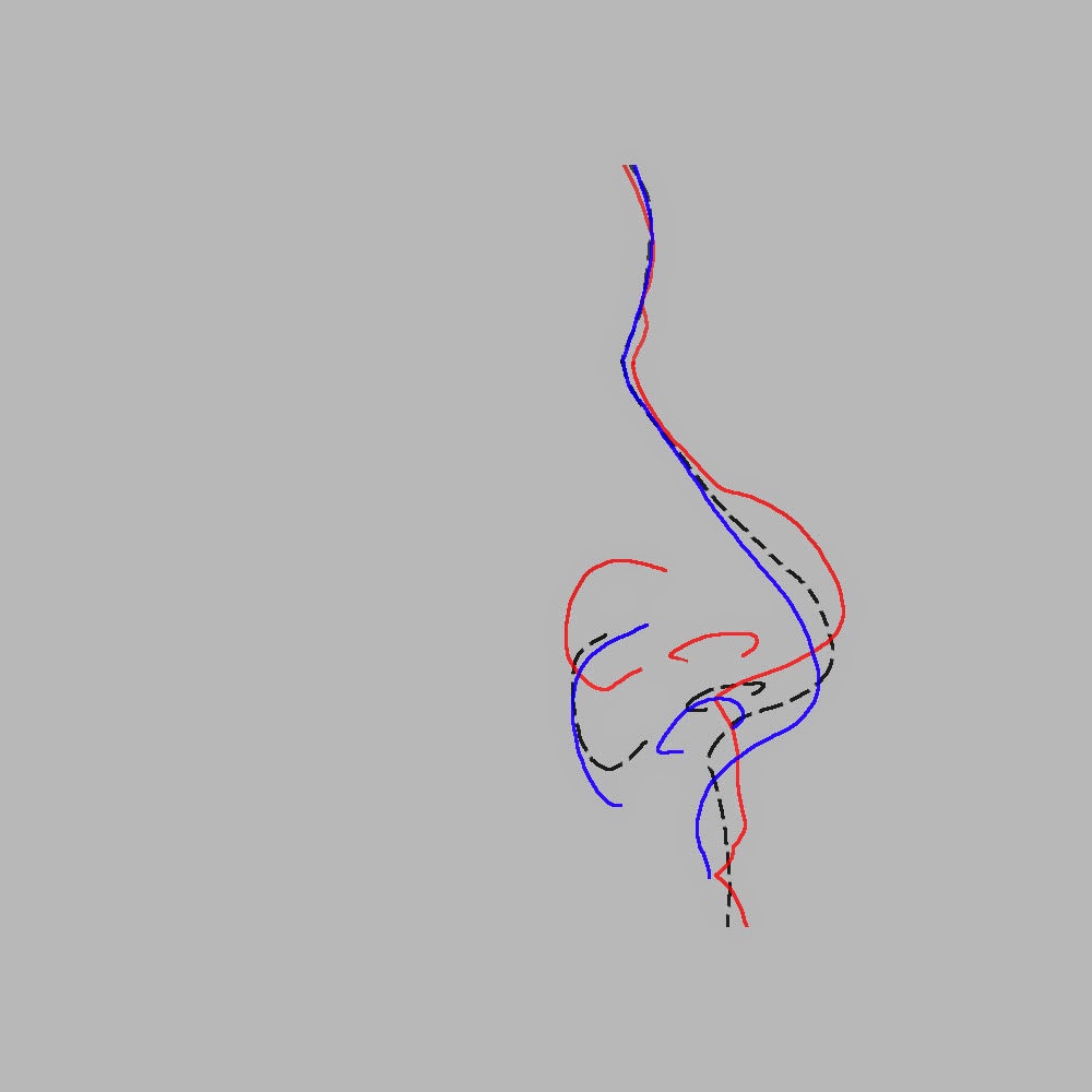 facial references for animation: nose movement [outline]