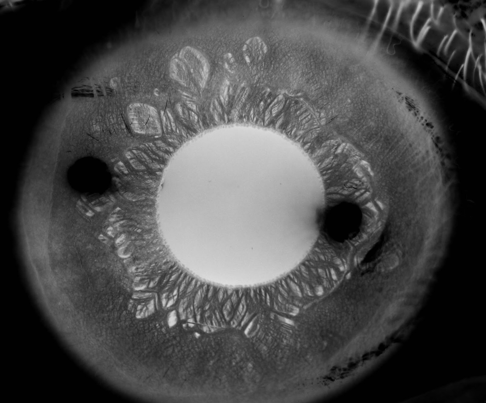 Modern & Multidimensional Iridology: Distended, Multi-Bridged & Linear ...