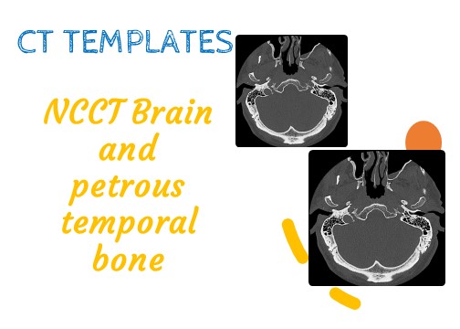 Non Contrast CT Scan of the Brain and Petrous-Temporal bone - RME
