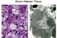 Brown fat cells (multilocular cells) |Genetic Engineering Info