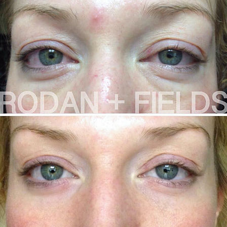 Wine About Beauty: Eye Crack