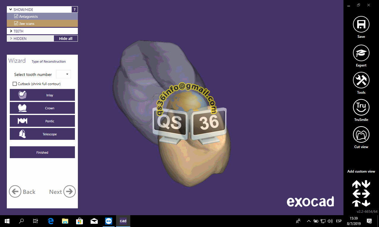 Exocad Wiki File:RegistrazioneModelliExocadIta.jpg - exocad