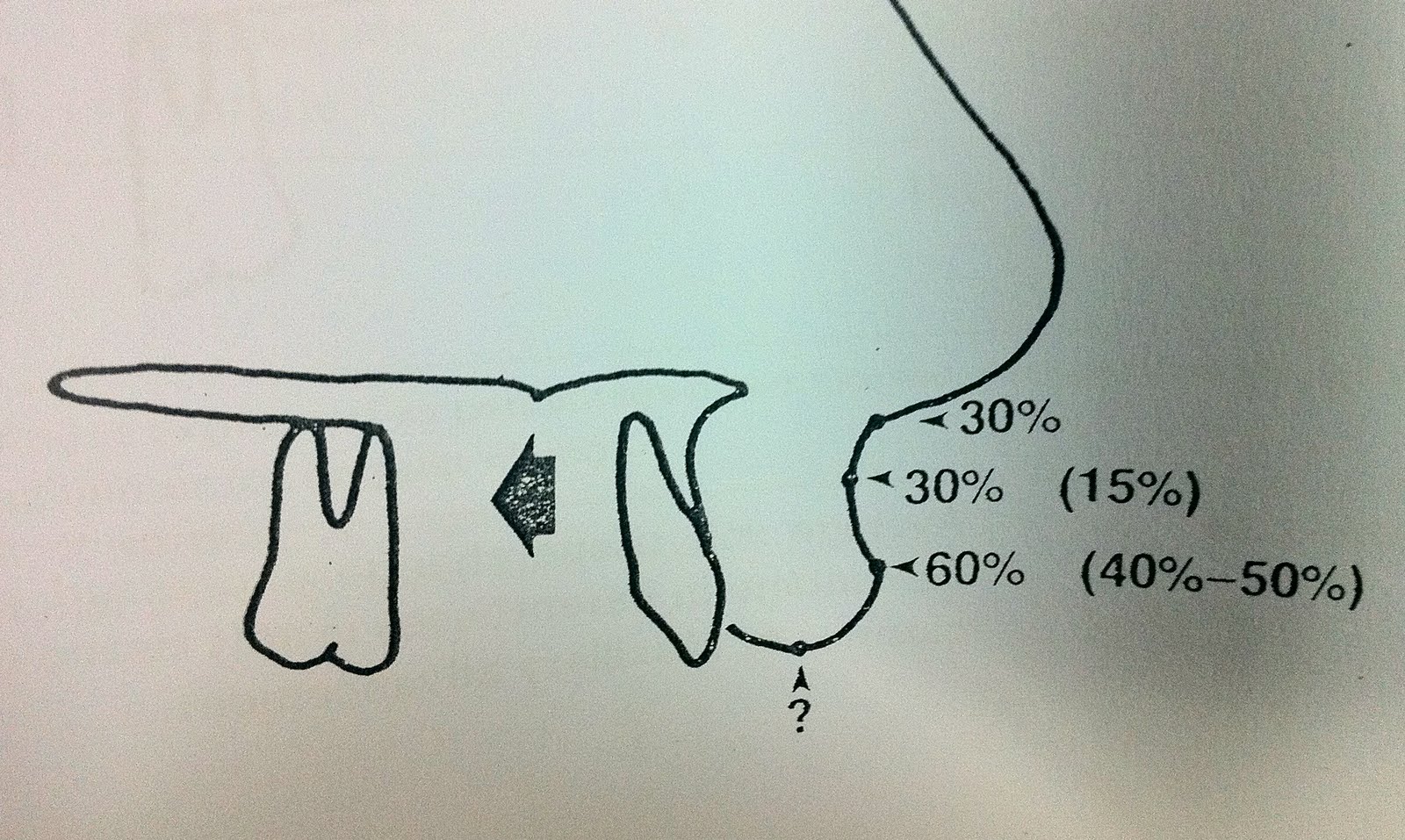 Anivat Blog Soft Tissue Cephalometric Landmarks