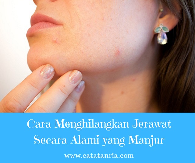 Catatan Ria: Ingin Tahu Cara Menghilangkan Jerawat Secara Alami Paling ... Catatan Ria: Ingin Tahu Cara Menghilangkan Jerawat Secara Alami Paling ...