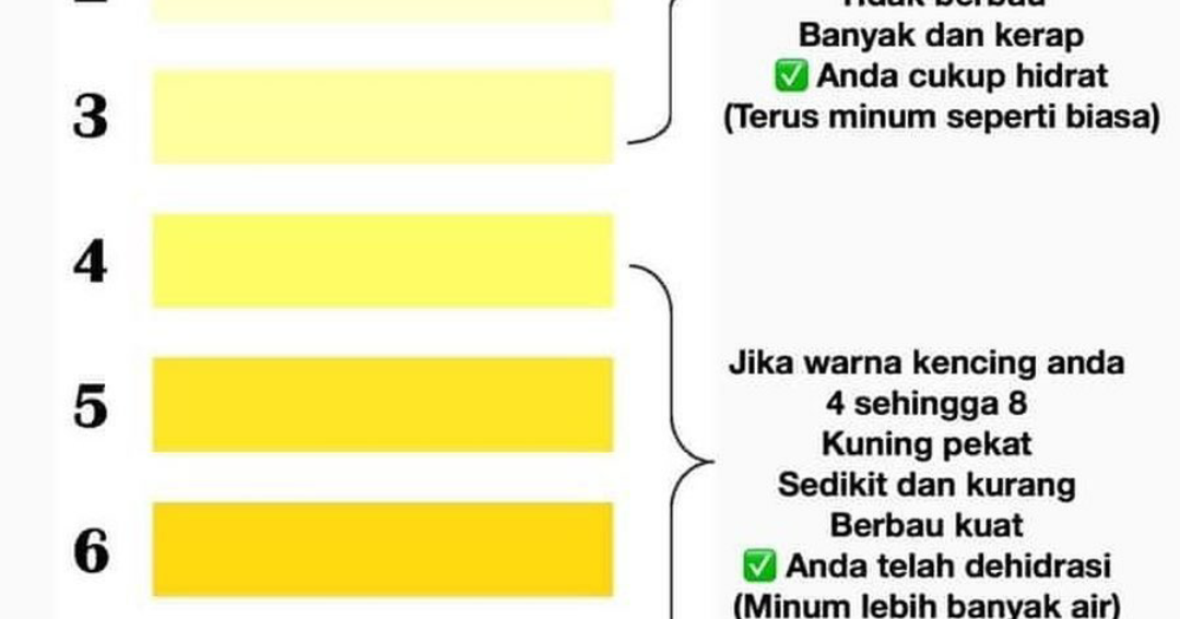 Apakah Warna Air Kencing Anda?