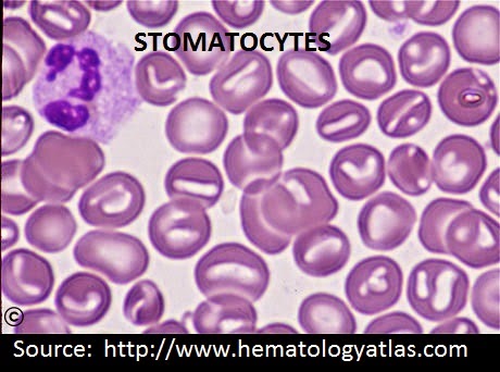 Lab Atlas: Stomatocytes
