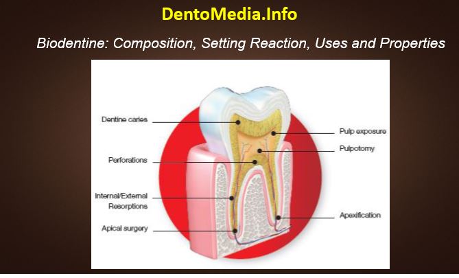 Biodentine: Composition, Setting Reaction, Properties and Uses