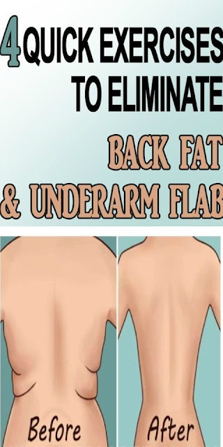 Eliminate Back Fat And Underarm Flab With 4 Quick Exercises! Eliminate Back Fat And Underarm Flab With 4 Quick Exercises!