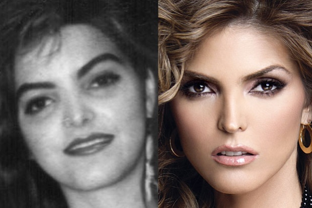 JOSEPH CACERES: LAS CIRUGIAS ESTETICAS DE LOS ARTISTAS