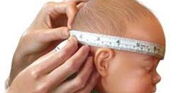 Macrocefalia e Microcefalia | A minha alma canta