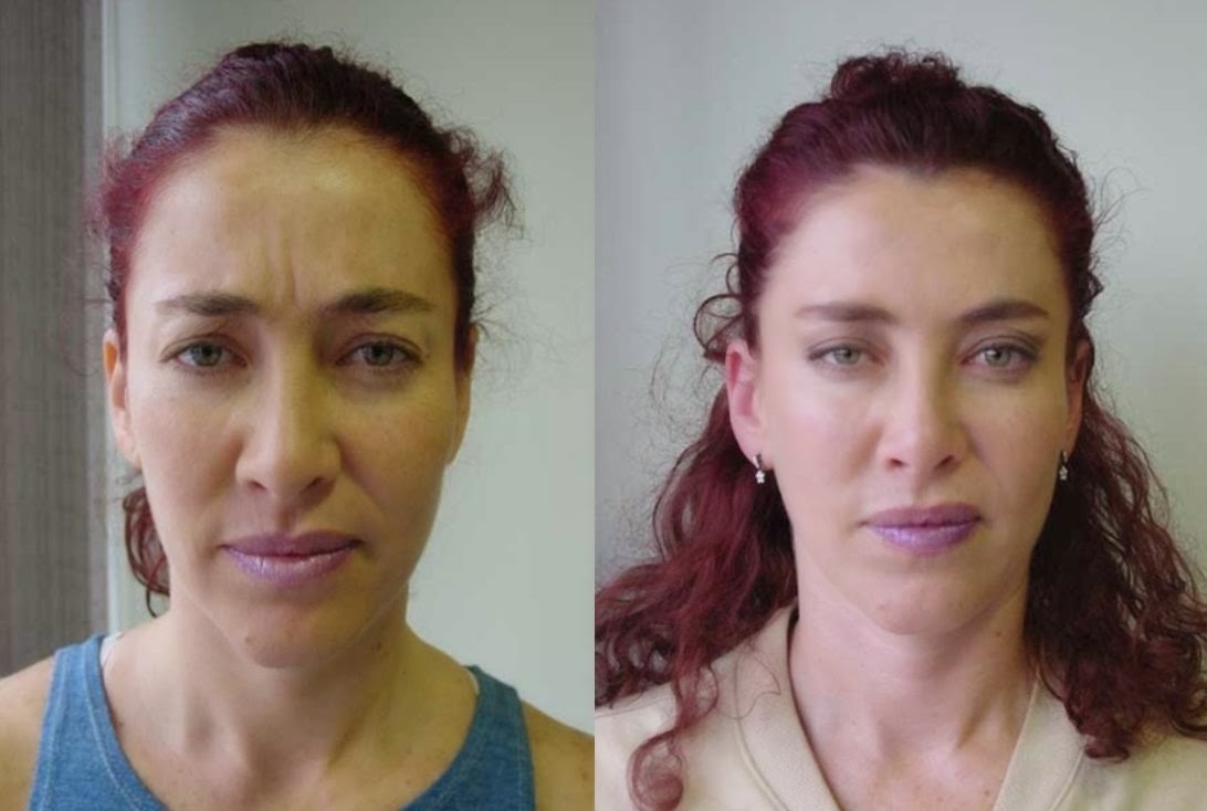 Yoga Facial Exercises For Rejuvenation Of The Neck And Face: Eleven ...