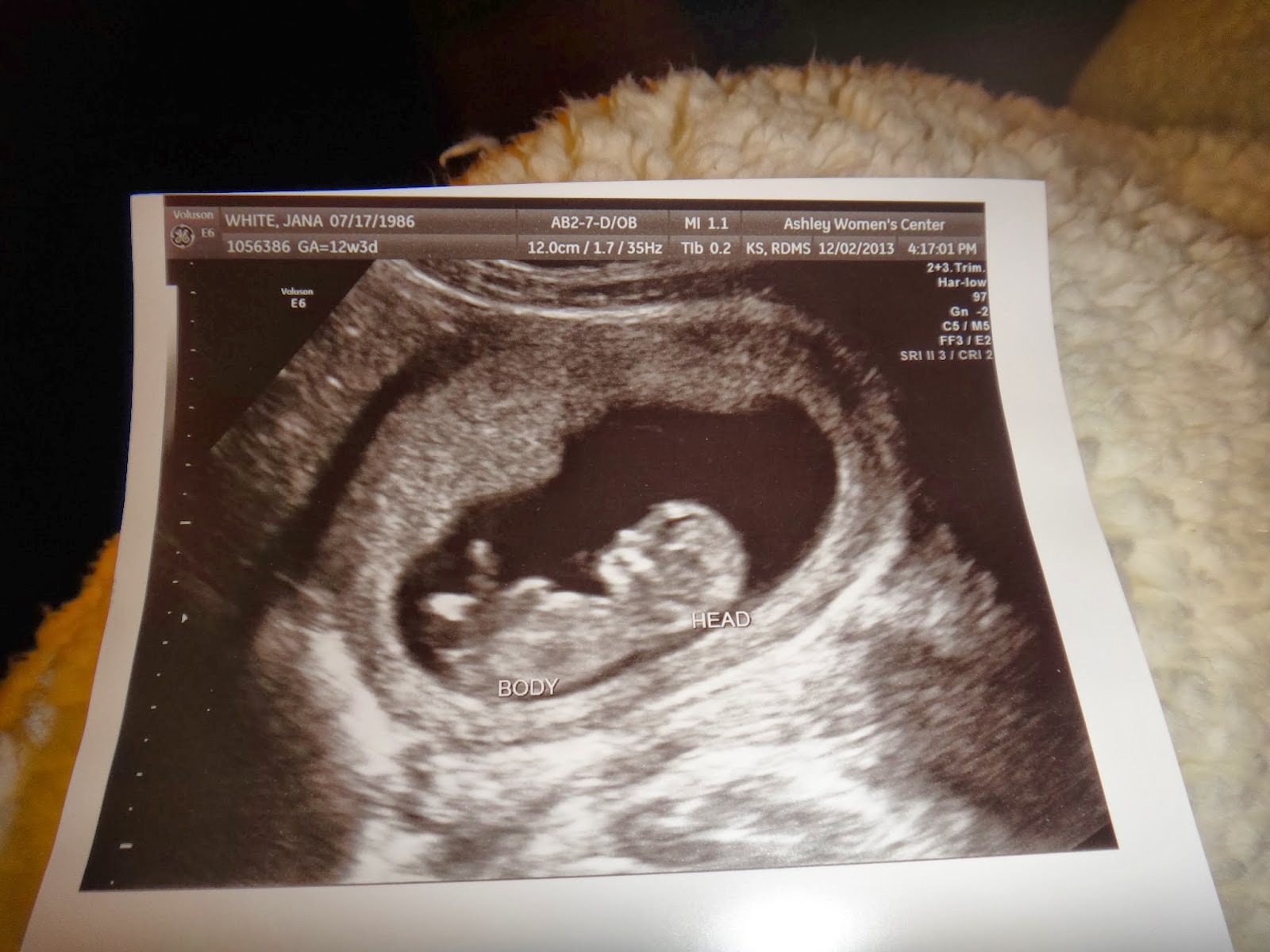 a wife, a mom, and a whole lot of grace: Our First Glimpse of You