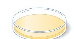 Merlins Micro World: Preparation of Nutrient Agar Plate