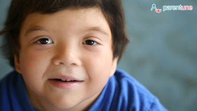 Signs and symptoms of Klinefelter syndrome