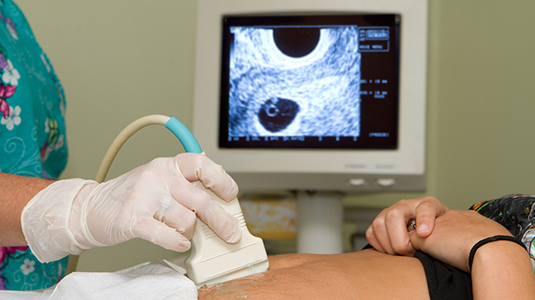 What are the Applications of Ultrasound?