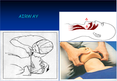 Materi Kebidanan: SYOK OBSTETRI