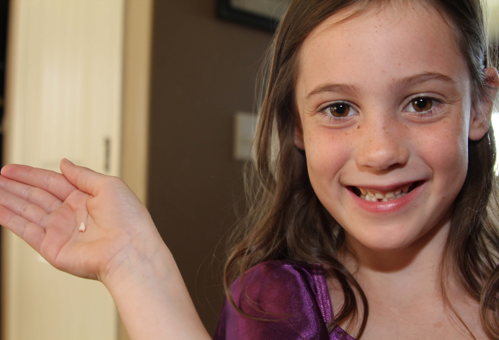 Newbry News: Finally Lost That Tooth