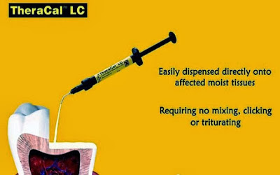 DENTAL MATERIALS: TheraCal LC - Technique Video - Odonto-Tv