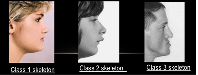 Facial Assessment- The consultation | Healthy Teeth Happy Smiles