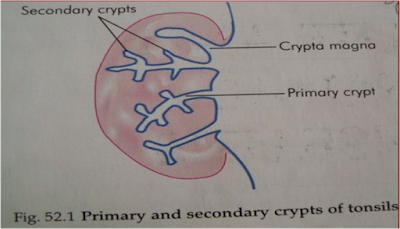 ENT-Throat infection-Tonsillitis