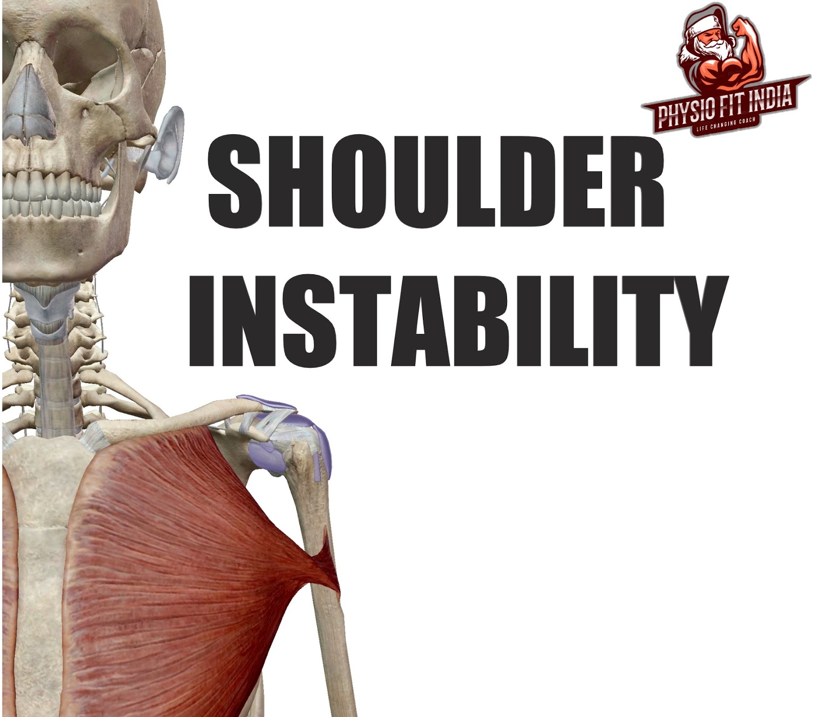 SHOULDER INSTABILITY / Management and Treatment