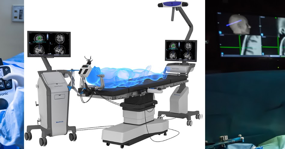 Stealth Autoguide from Medtronic