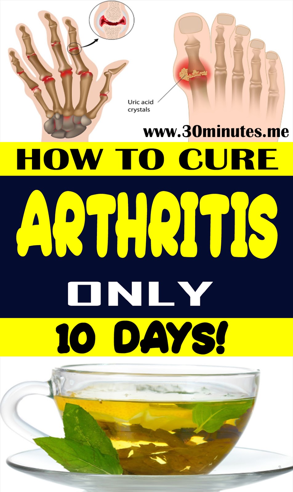 10 YEARS GOING TO THE DOCTOR TO CURE MY ARTHRITIS AND THIS TEA MADE IT ...