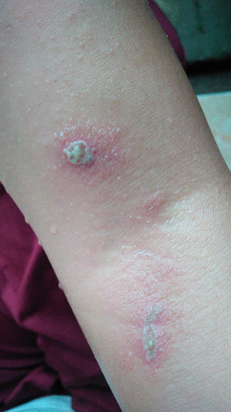 Marsela Blog: Mengatasi Gigitan Tomcat