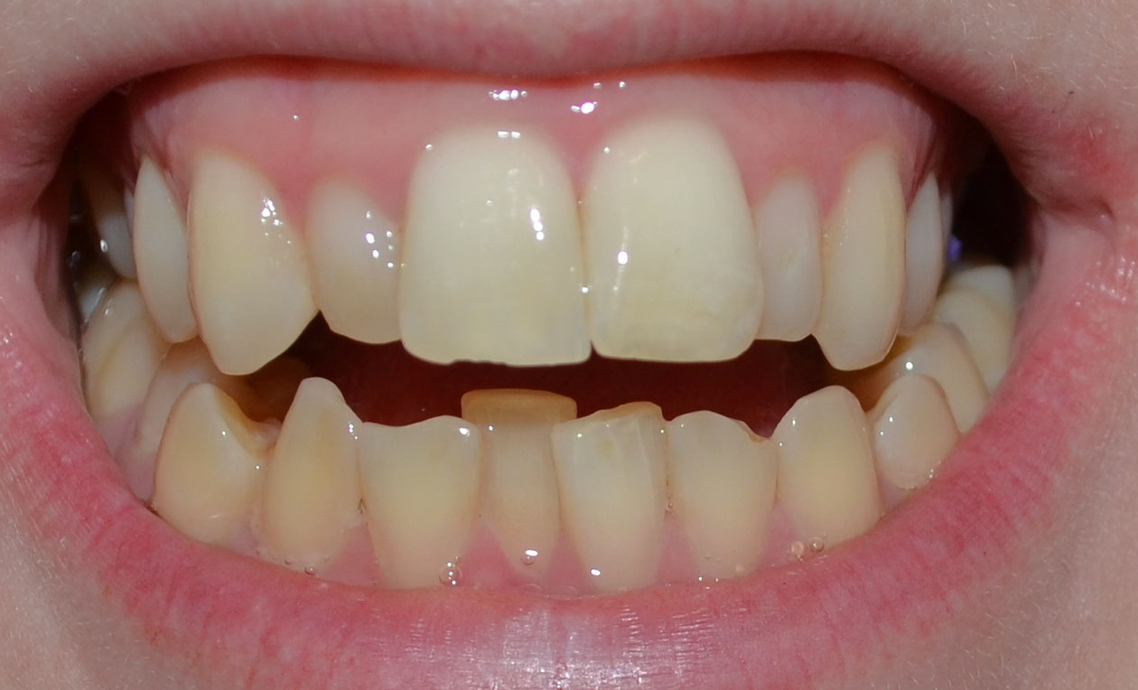 Amy's SARPE Adventure