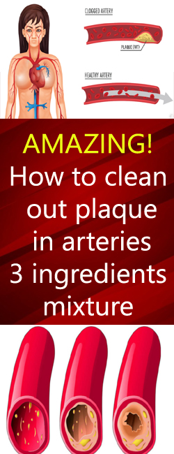 How to clean out plaque in arteries – 3 ingredients mixture - nutrition ...