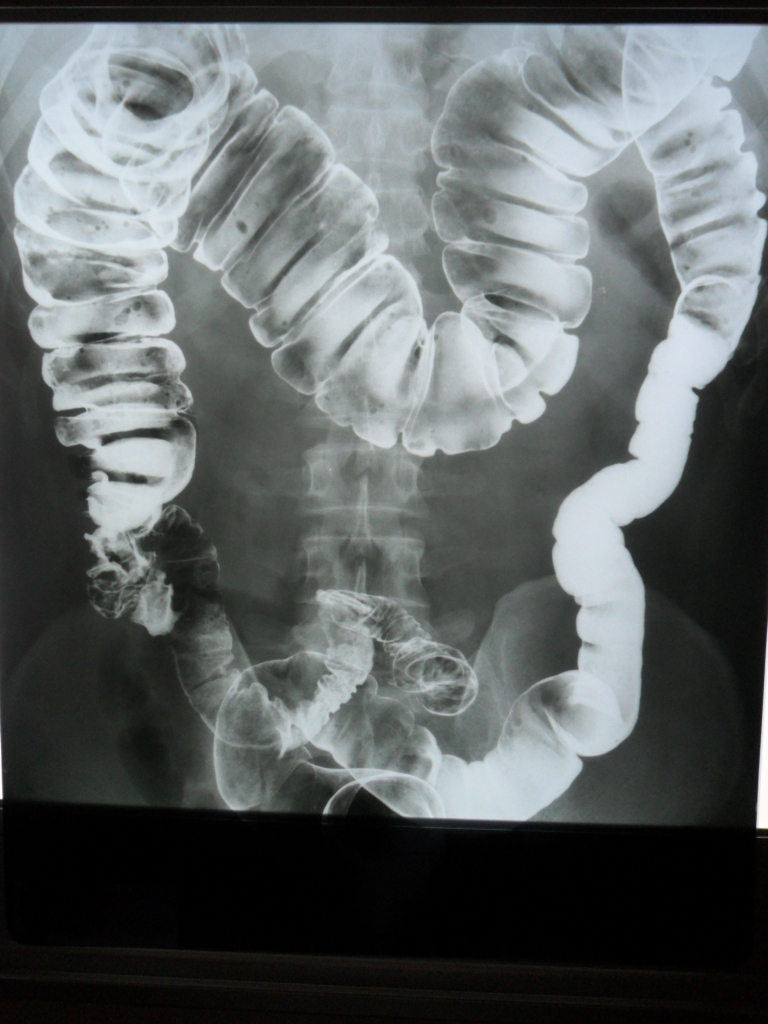 RADIOLOGIA ROCLA PARAGUAY.: IMÁGENES INTERESANTES