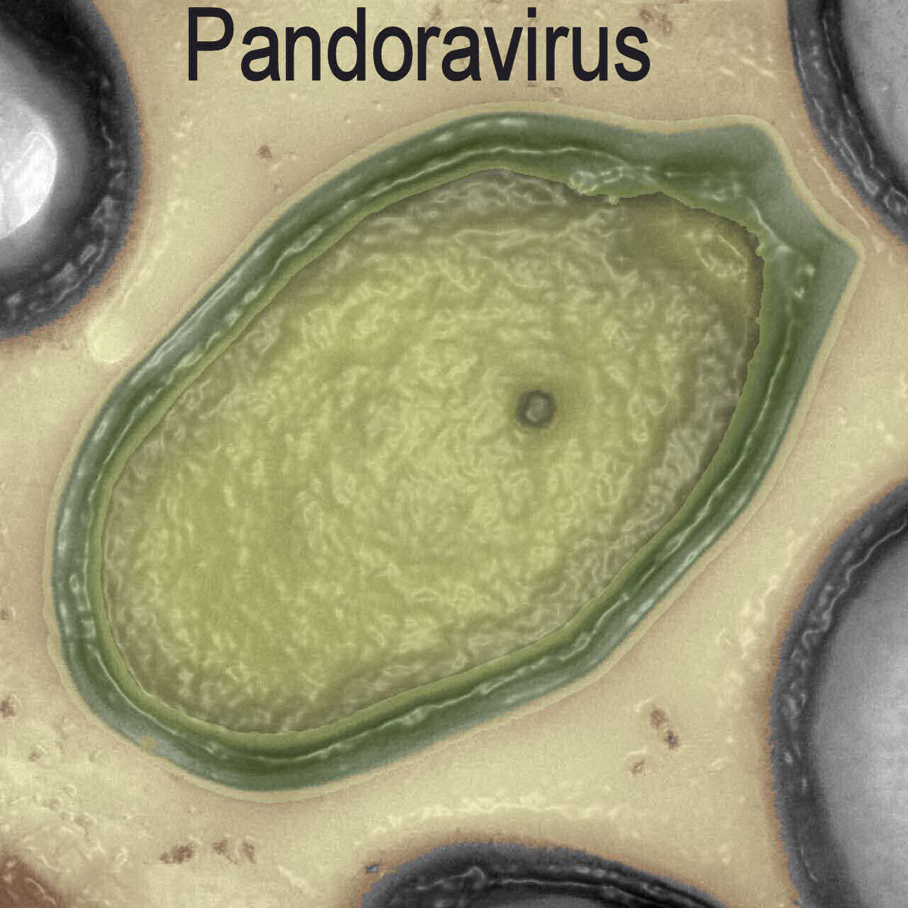 Medical Laboratory and Biomedical Science: Pandoravirus, bigger and ...