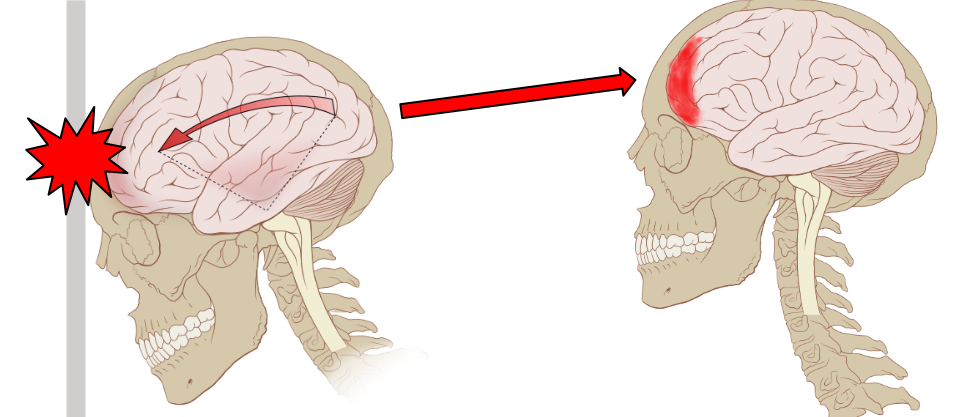 Deve-se evitar dormir logo após um traumatismo craniano? - Saber Atualizado