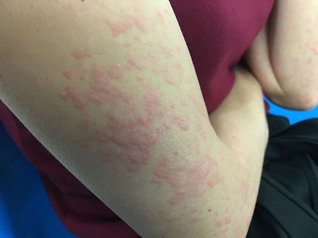 Rashes and Skin Lesions : LABORATORY AND DIAGNOSTIC STUDIES