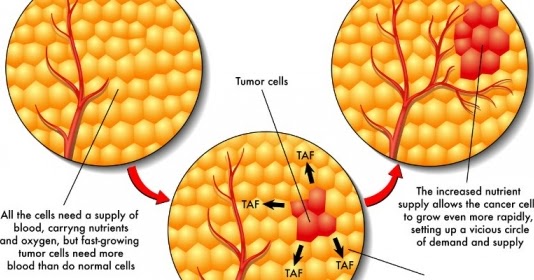 Undisputed Man: Neoplasma